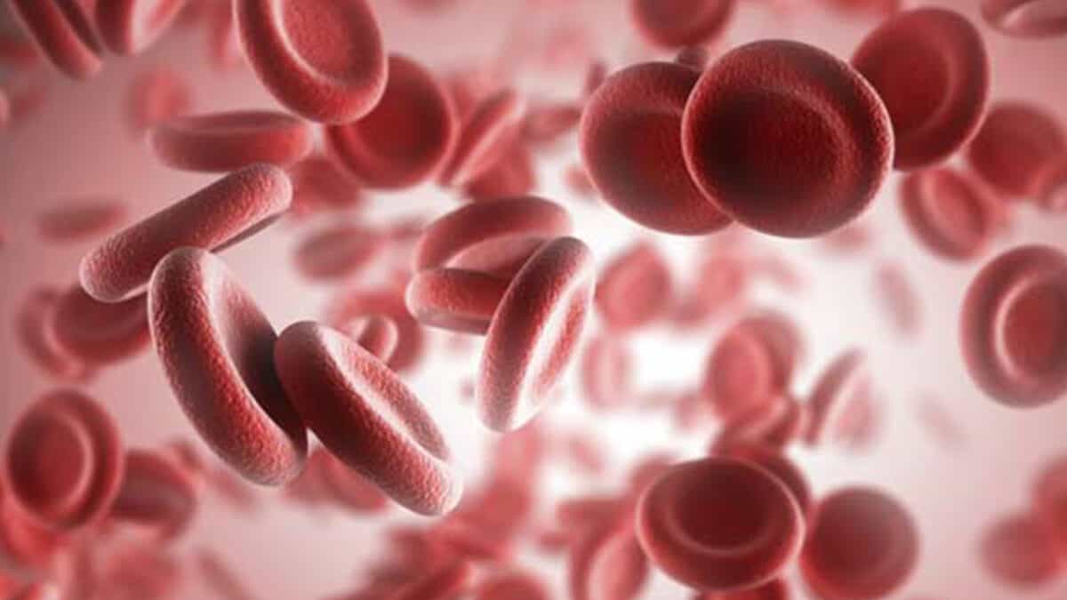 Anaemia - Fun Kids - the UK's children's radio station