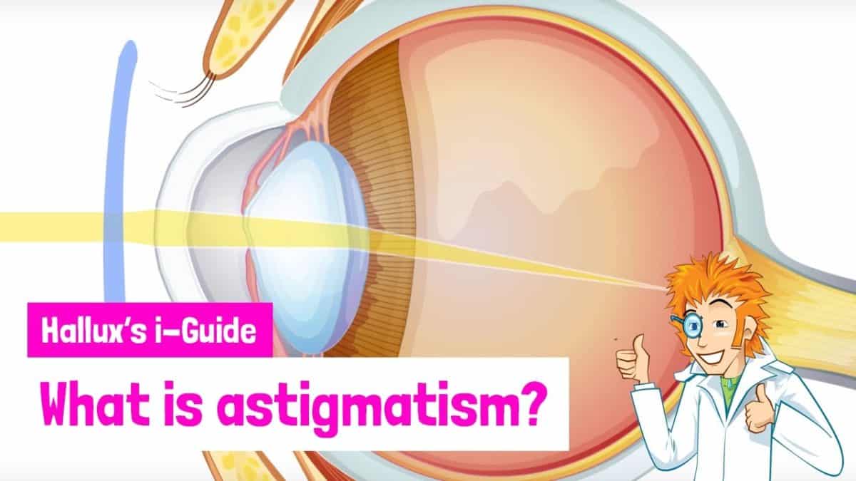 Hallux s I Guide What Is Astigmatism Fun Kids The UK s Children s