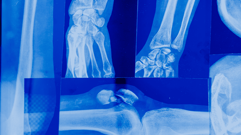 A to Z of Engineering: X is for X-Rays - Fun Kids - the UK's children's ...