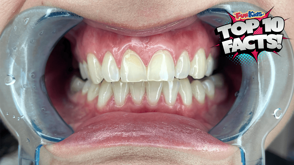 Top 10 Facts About Teeth! - Fun Kids - the UK's children's radio station